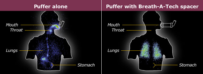 Breath-A-Tech Spacer (Single)