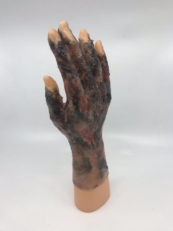 Mb215 Glove Burned Hand