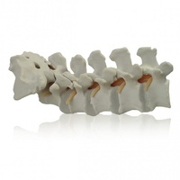 Simulation Surgical Simulation Orthopaedics